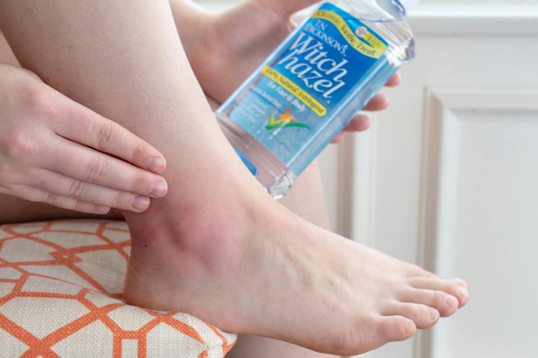 11 Unexpected Ways to Use Witch Hazel - The Krazy Coupon Lady